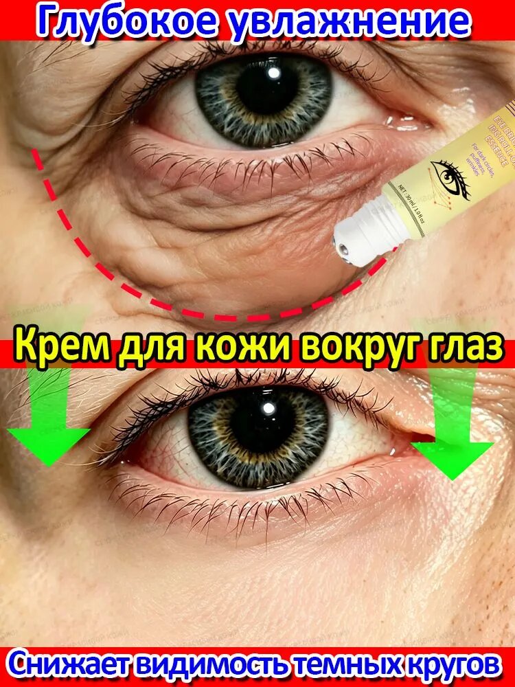 Крем против морщин способен устранить темные круги, мешки под глазами, отечность, меланин, морщины и восстановить жизненную силу молодости. 90 мл, Крем для массажа глаз.