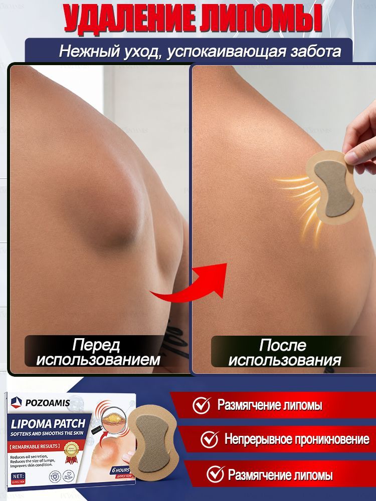 Пластырь от липомы, для ухода за подкожными жировыми зонами, быстрое улучшение состояния кожи, 15 шт
