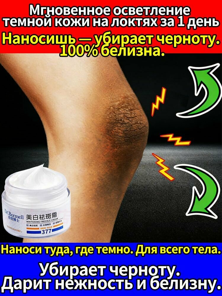 Лидер продаж. Отбеливающий крем, подходит для выравнивания тона кожи в таких зонах, как подмышки, шея, пах, интимные зоны, локти, колени и складки на теле, для быстрого отбеливания, 50 г
