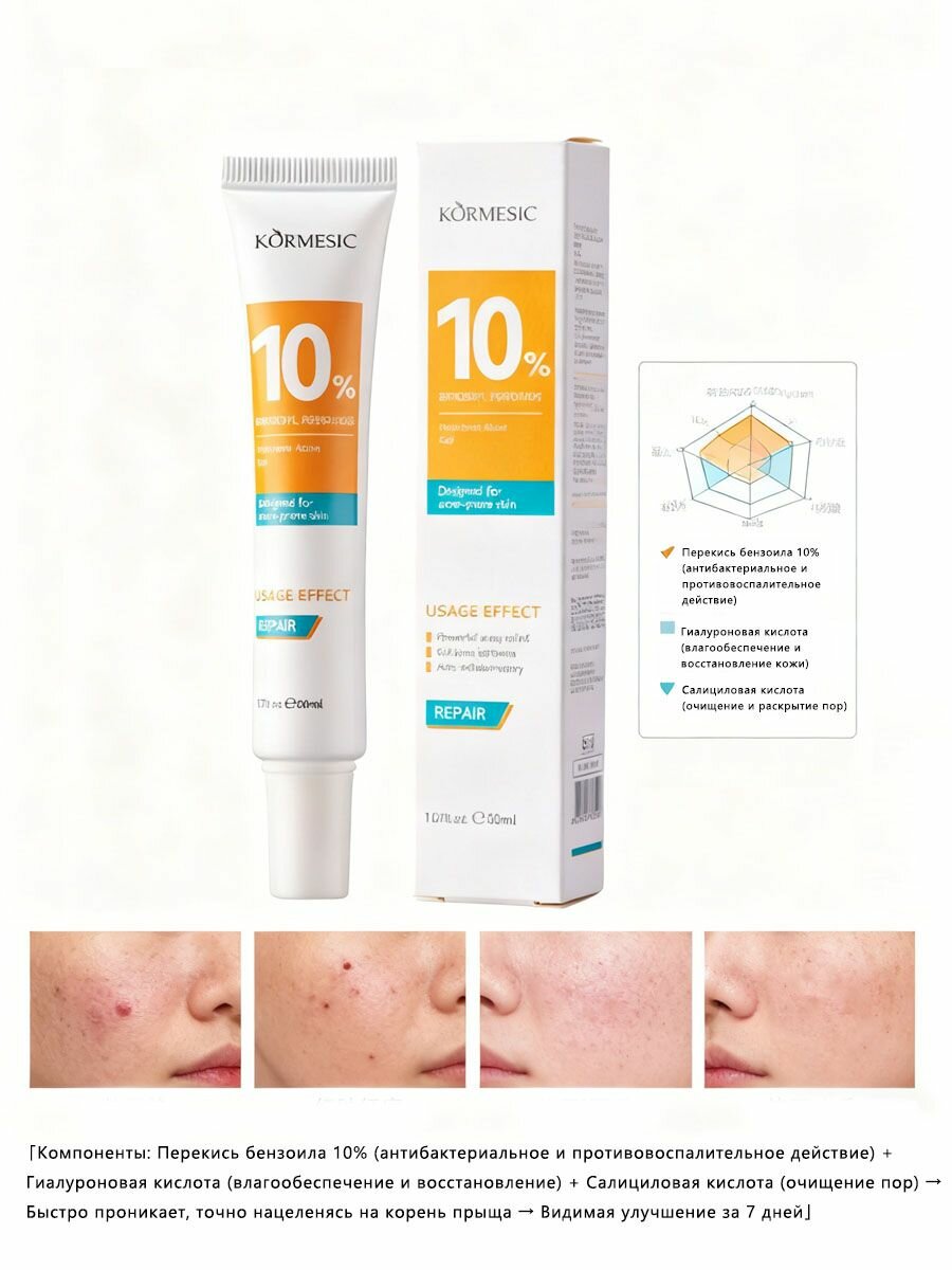 Kрем-гель против прыщей и акне, 10% Бензоил Пероксид , 30 ml