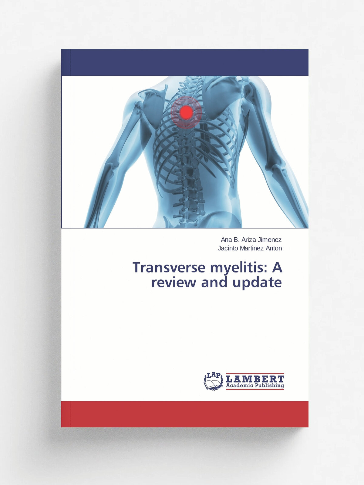 Transverse myelitis. A review and update