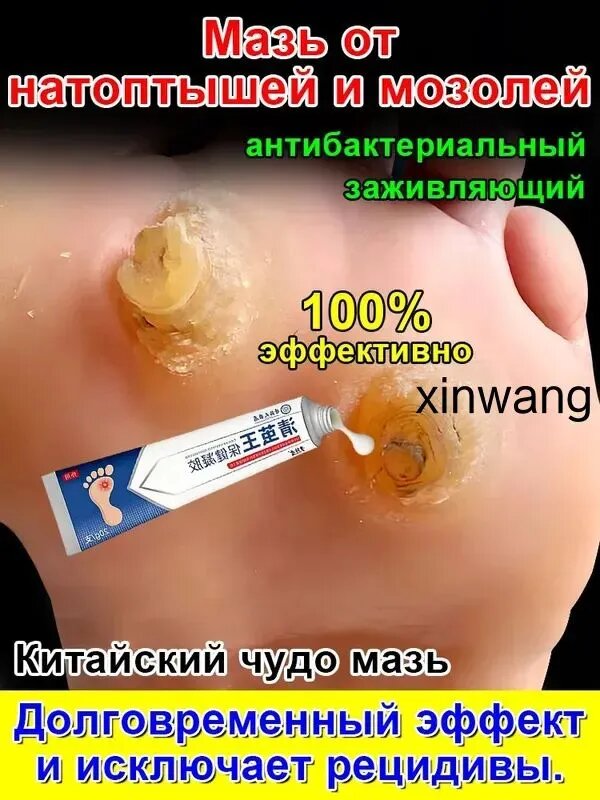 Mазь от мозолей стержневых и натоптышей , Крем от сухих мозолей, шипицы, бородавок, натоптышей,20 г.