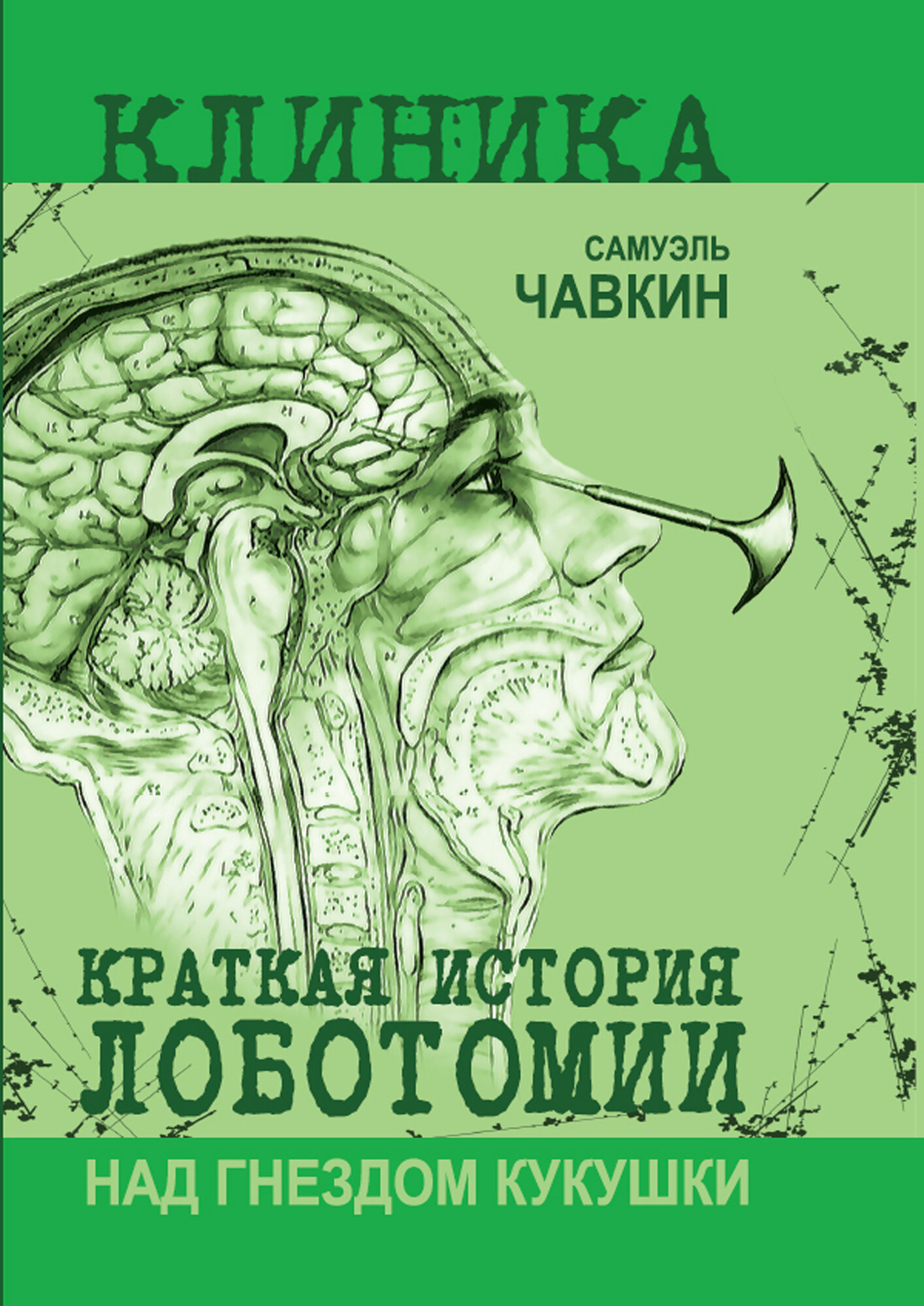 Над гнездом кукушки . Краткая история лоботомии (Клиника)_ Чавкин С.