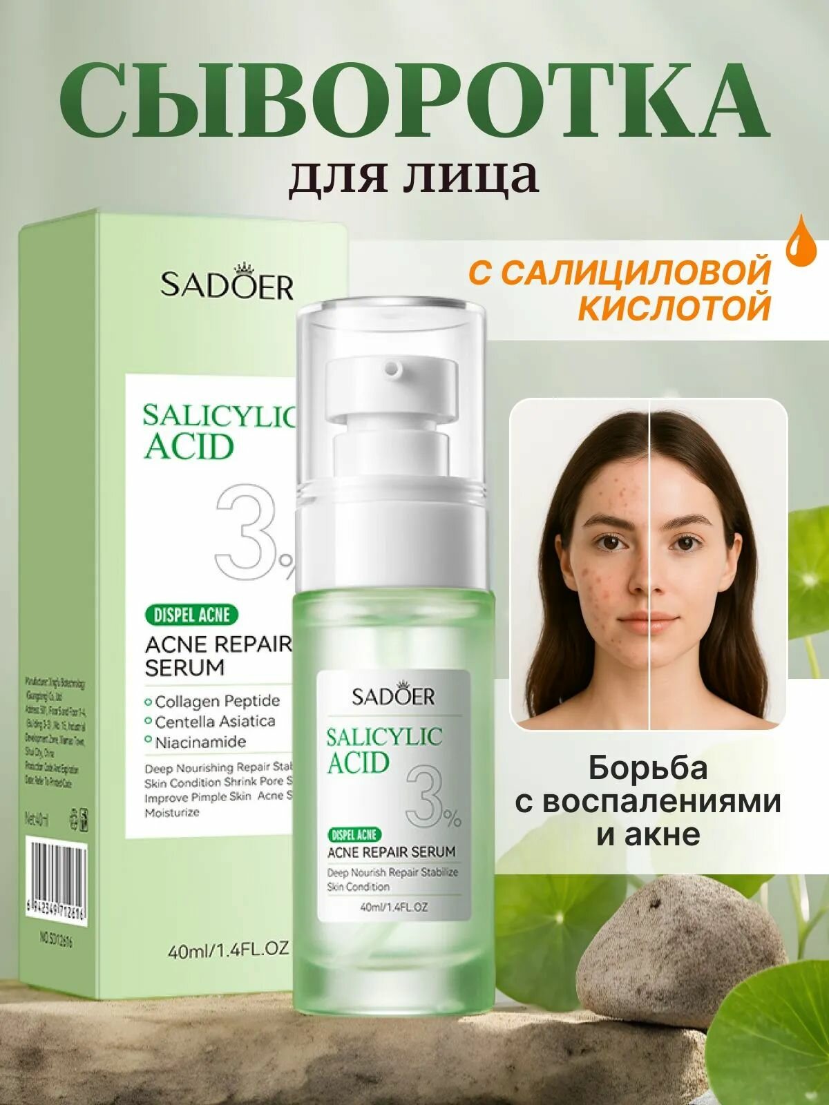 Сыворотка от прыщей 30ml Сыворотка c cалициловой кислотой 1шт Sadoer