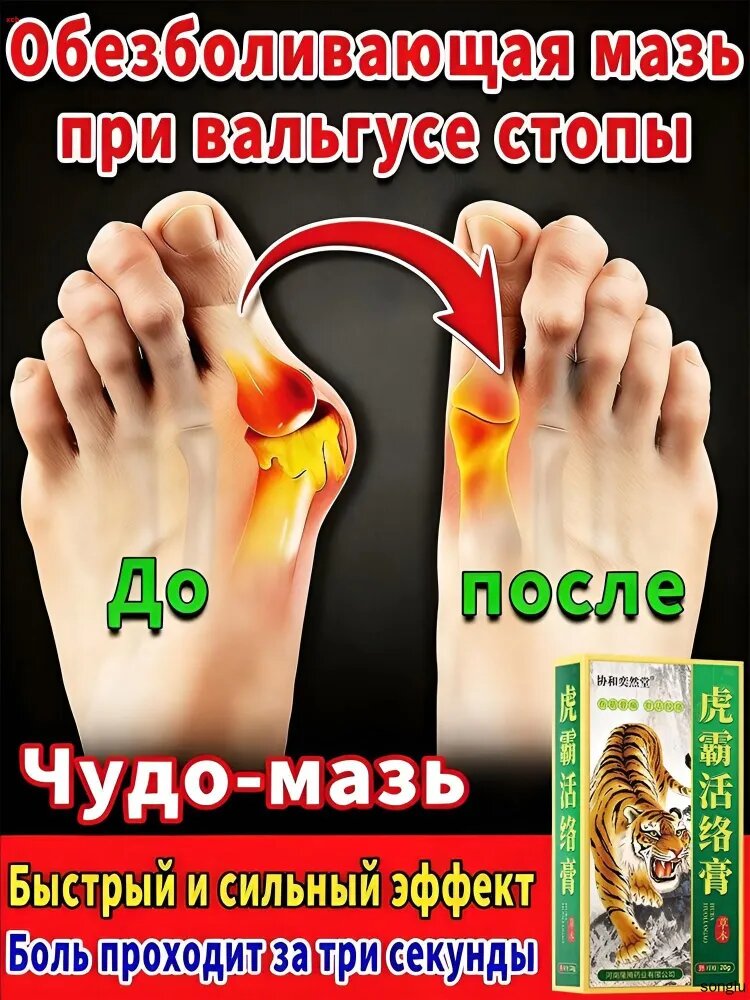 Мазь от косточки на большом пальце, от шишек на больших пальцах ног