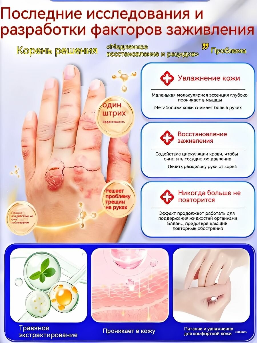 Уродерм мазь ног с мочевиной и пантенолом от трещин мозолей