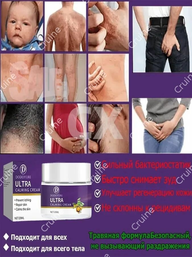 Мазь от псориаза Негормональная мазь от зуда для лечения псориаза, дерматита и экземы, порезов, облегчения зуда, 20 г.