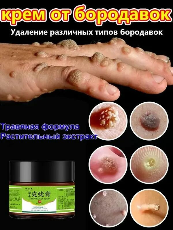 Крем от папиллом и бородавок Для лечения бородавок, папиллом, мозолей на теле и лице Чистотел, без шрамов ,20 г