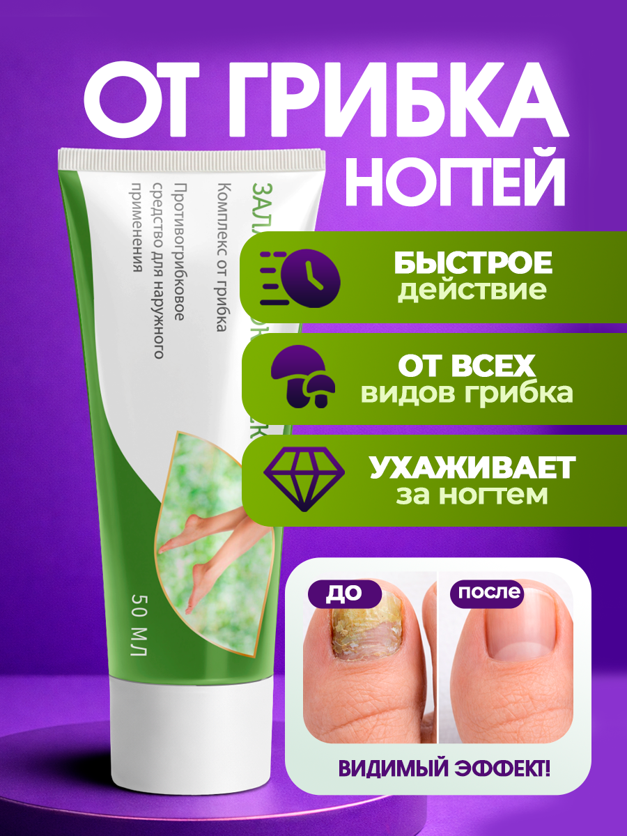 Залагрибокпротект, крем от грибка ногтей и стоп: быстрое устранение зуда и запаха, туба 50 мл