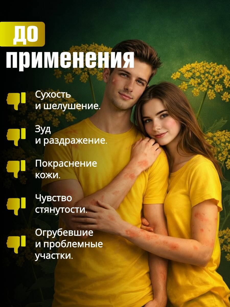 Средство при псориазе "Акрустал нео", туба 50 мл, защита, восстановление