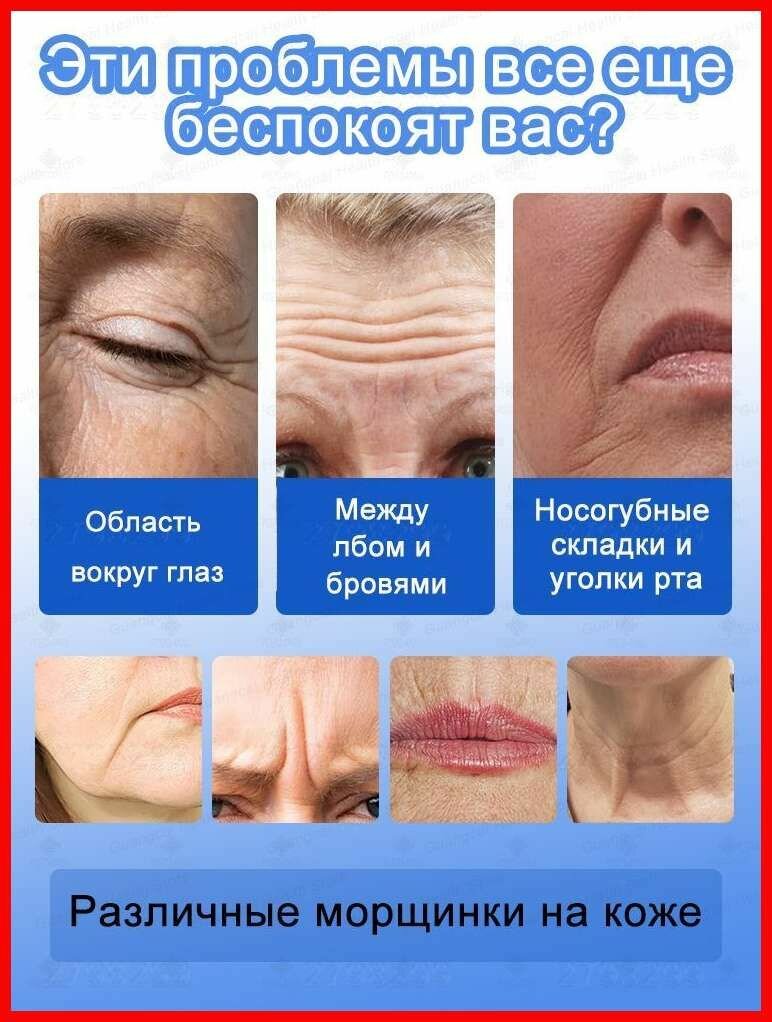 Антивозрастная эссенция, антивозрастное средство, быстрое удаление морщин, отбеливание, увлажнение, сужение пор, для ухода за кожей, 30 г/упаковка любого типа кожи
