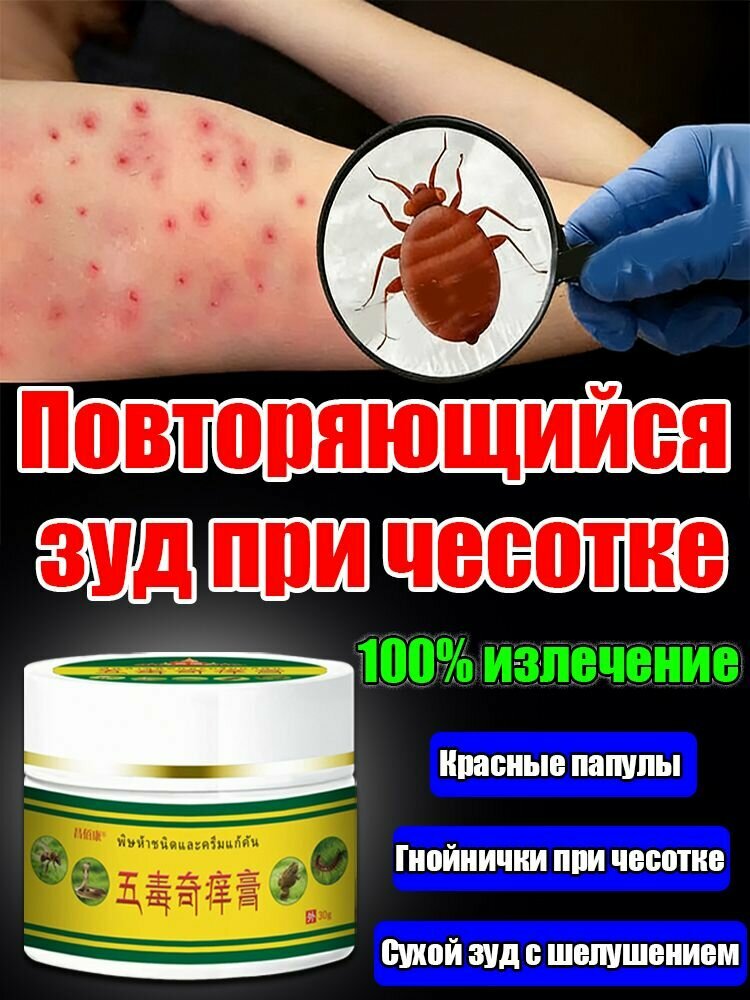 Мазь от укусов постельных клопов и комаров