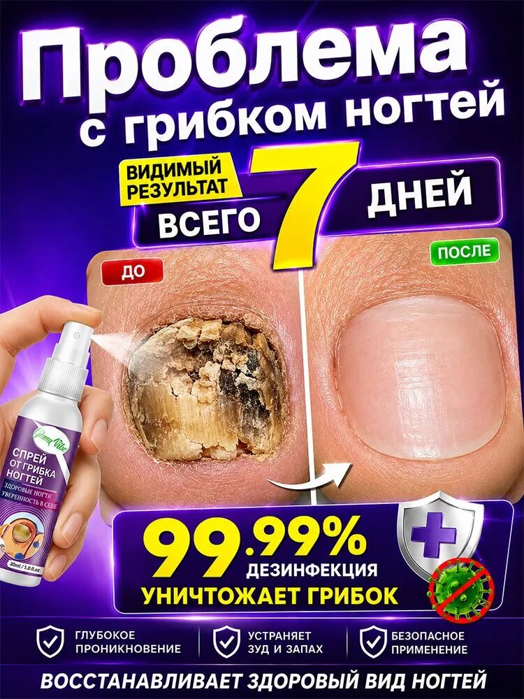 Спрей для удаления грибка ногтей, быстро лечит грибок ногтей, восстанавливает ногти, снимает зуд, дезинфицирует и подавляет бактерии, мягкий и не вызывающий раздражения. 150 мл