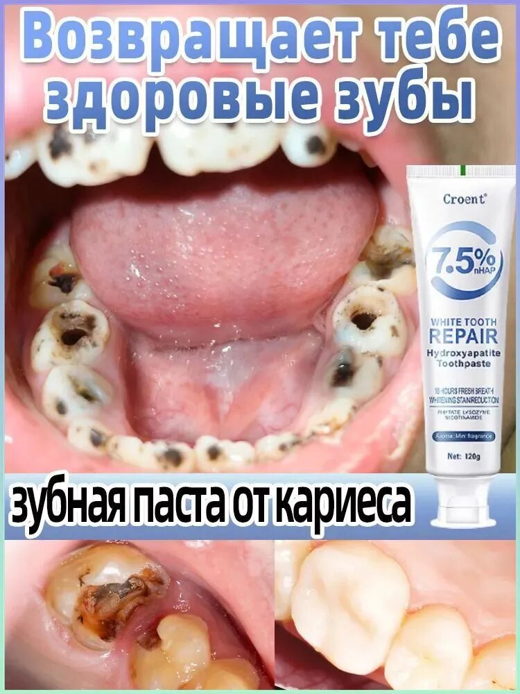 Зубная паста 7,5% гидроксиапатита восстановление эмали предотвращение кариеса