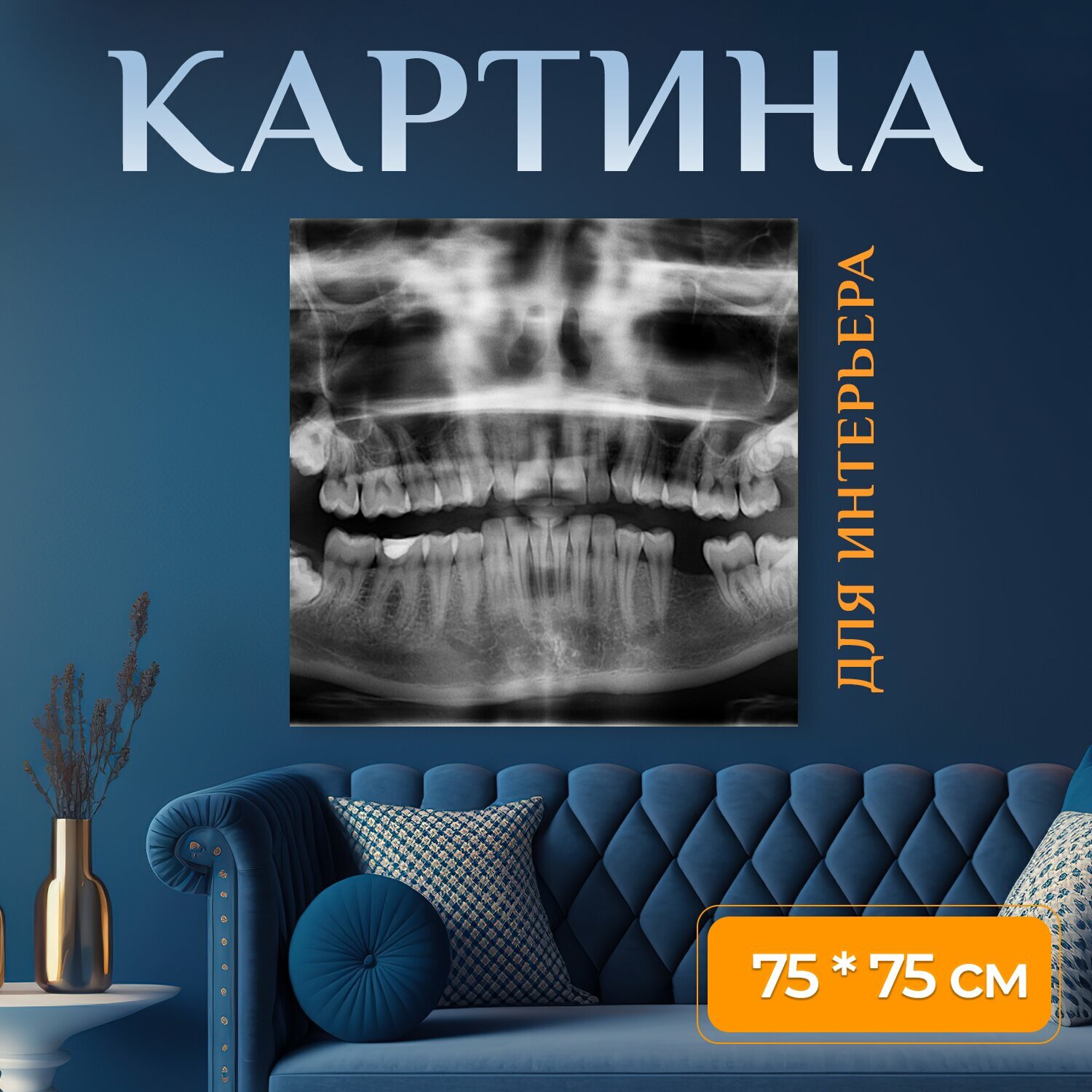 Картина на холсте "Рентген, зубы, зуб отсутствует" на подрамнике 75х75 см. для интерьера