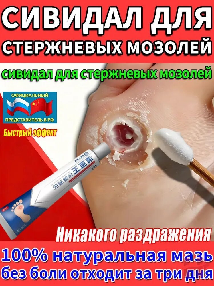 Средство от шипиц, натоптышей и сухих стержневых мозолей на ногах мазь и гель Корнекс, эффективное китайское средство