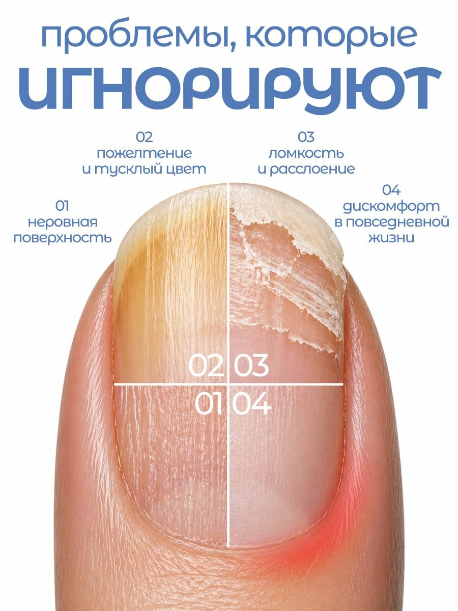 Масло для ногтей от грибка, средство для лечения грибка Nail, 10 мл, лечение онихолизиса