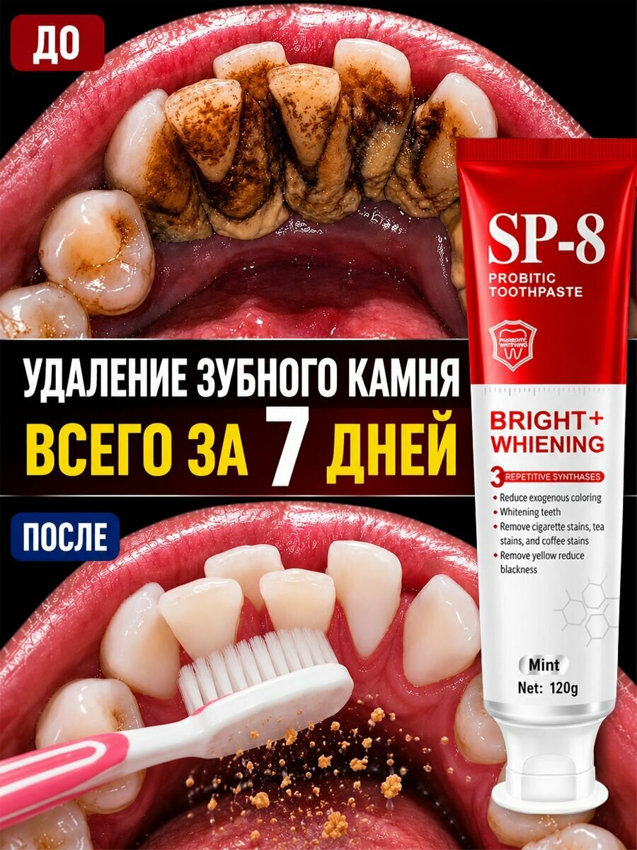 Отбеливающая зубная паста с пробиотиками Croent SP-8, удаление налета и желтизны, свежее дыхание, защита эмали и десен, для чувствительных зубов, профессиональный уход, 100 г