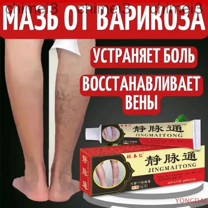 Китайская мазь от варикоза вен на ногах Джинг Май Тонг