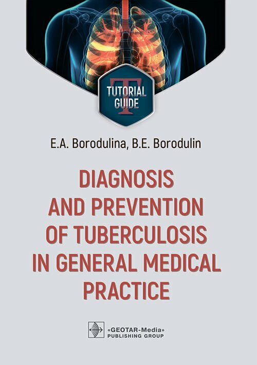 Diagnosis and prevention of tuberculosis in general medical practice : tutorial guide / E. A. Borodu