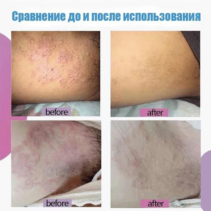 Лечебное средство — фото 1