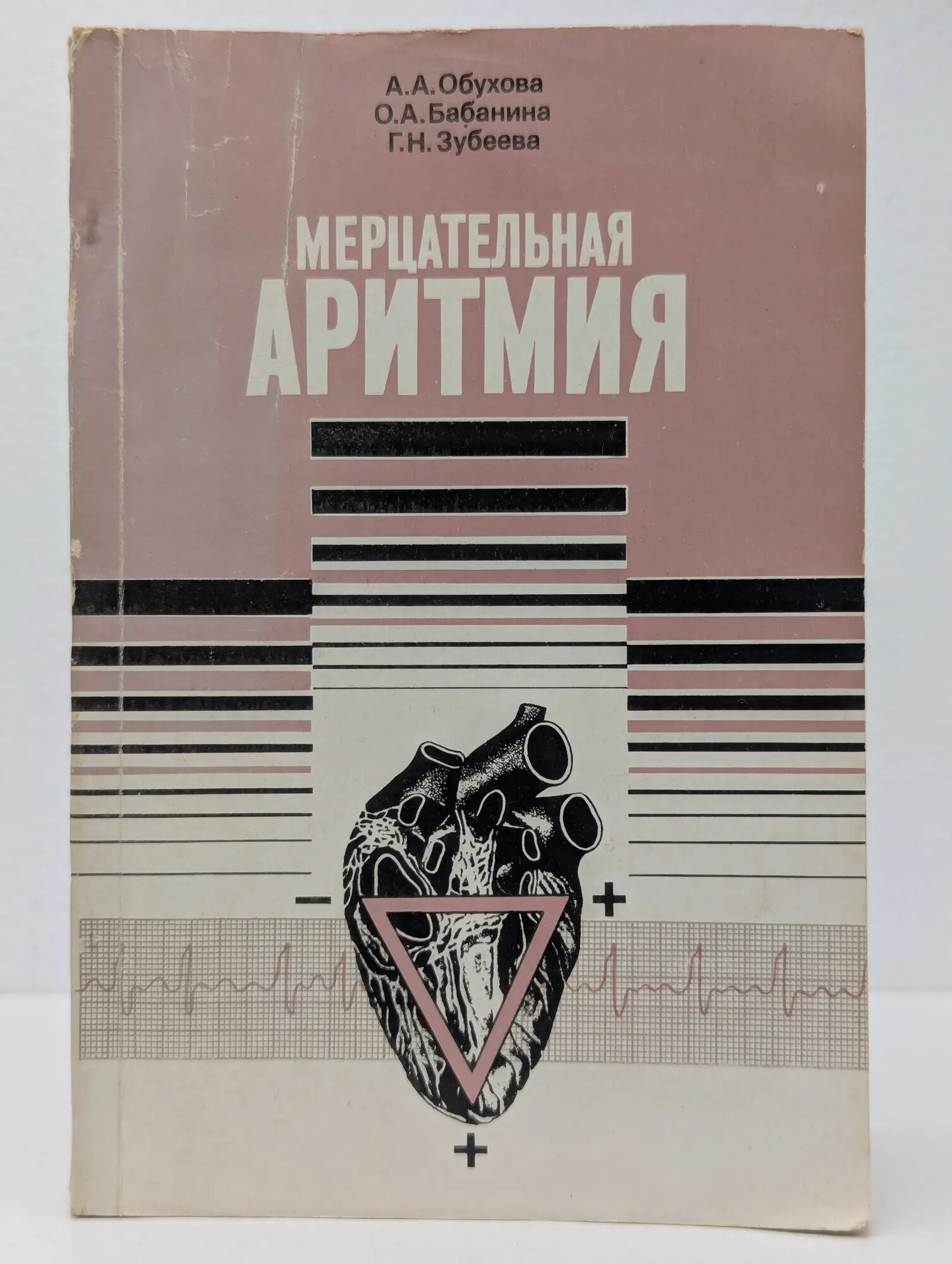 Мерцательная аритмия Обухова Ариадна Александровна, Бабанина Ольга Александровна, Зубеева Галина Николаевна 1986