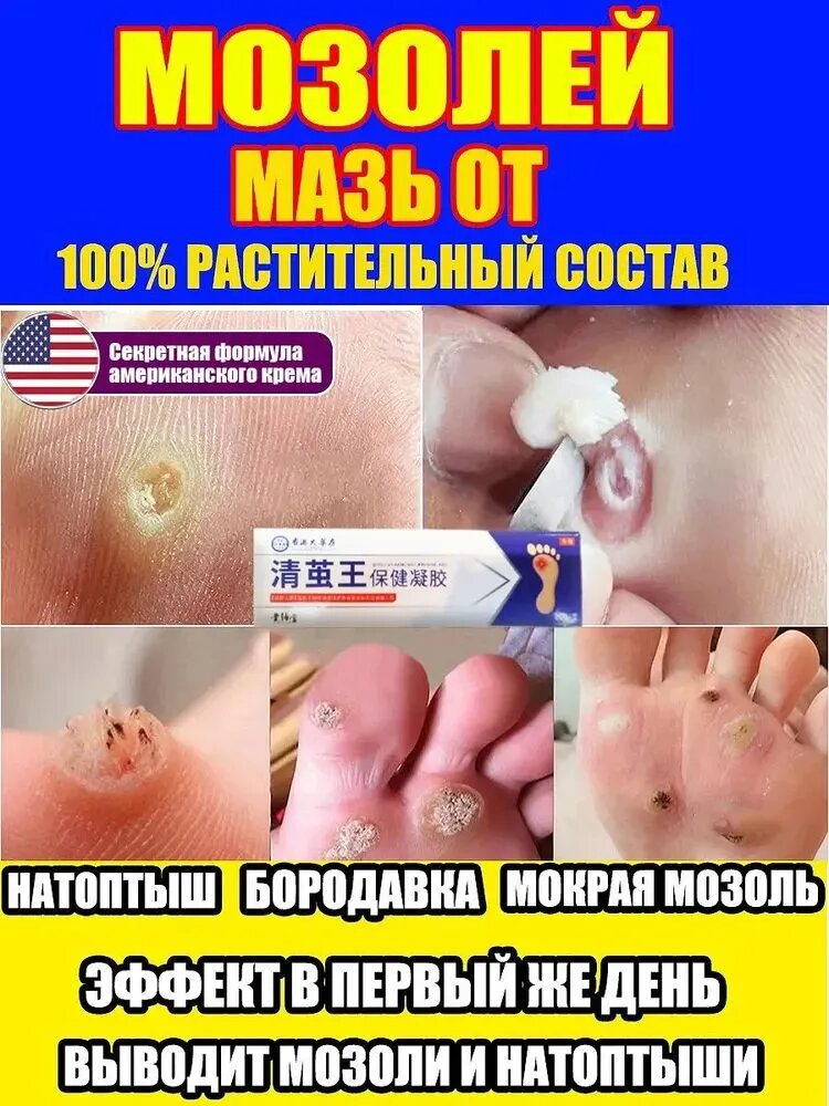 Крем от сухих мозолей и натоптышей. Мозольный бальзам для пяток, пилинг для ног. Быстрый эффект/20 г