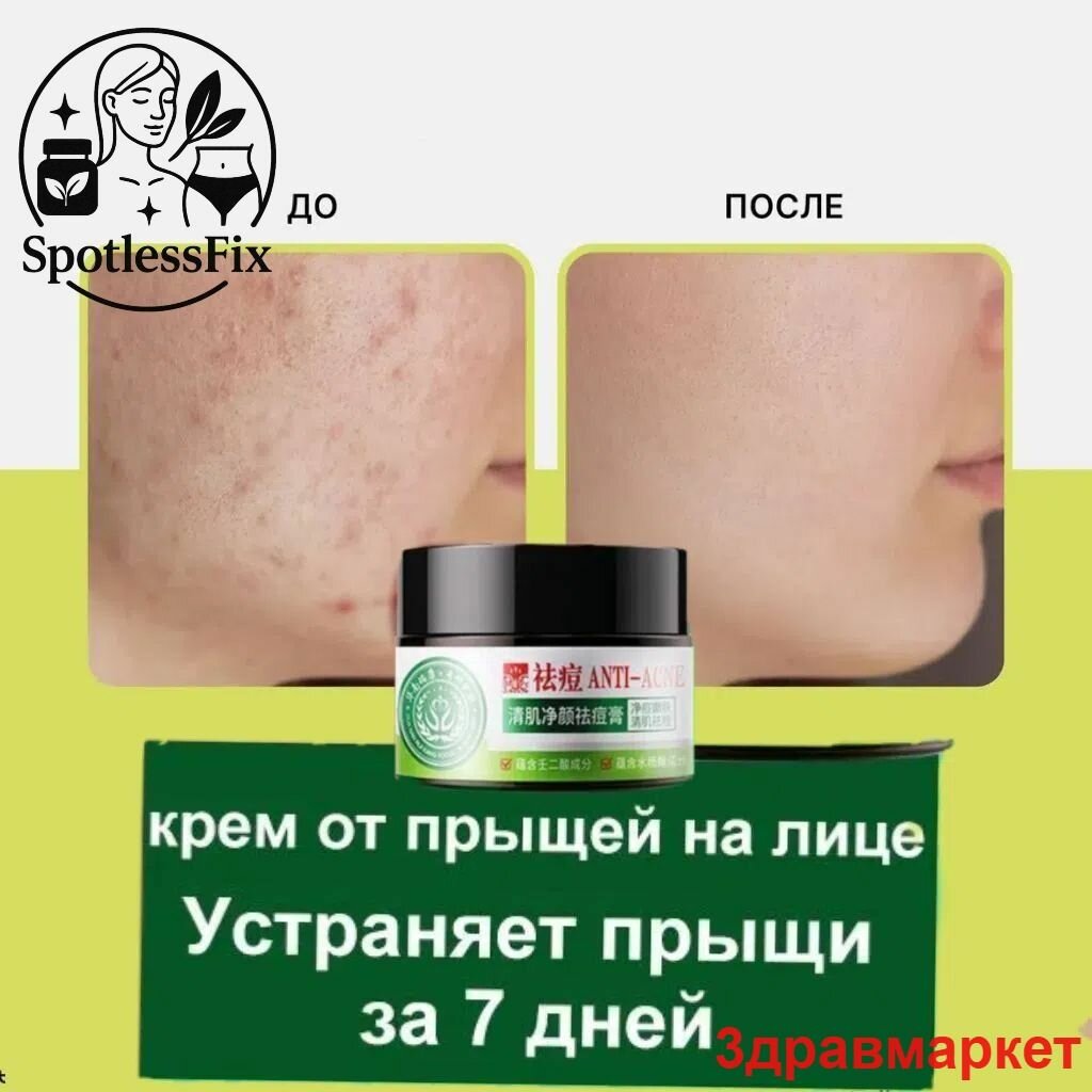 Крем для лица от акне прыщей воспалений, постакне быстрое заживление , для наружного применения, для подростков и взрослых 30 г