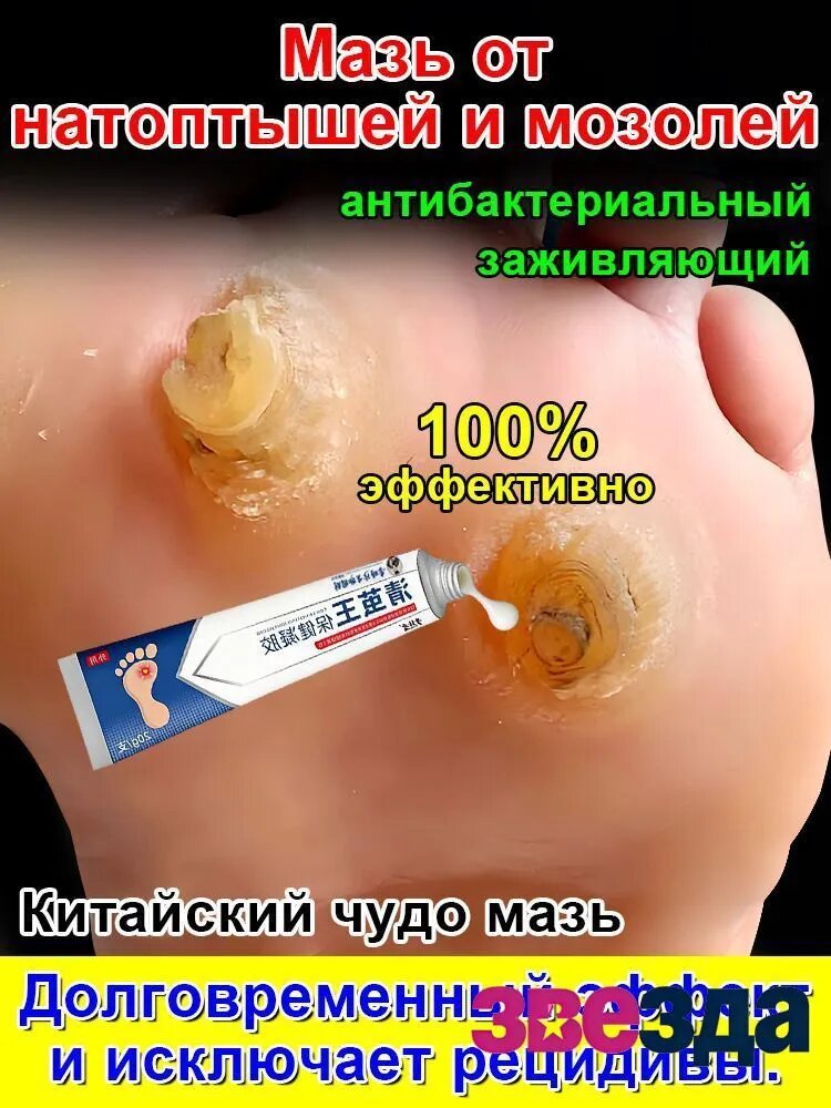 Mазь от мозолей стержневых и натоптышей , Крем от сухих мозолей, шипицы, бородавок, натоптышей,20 г.