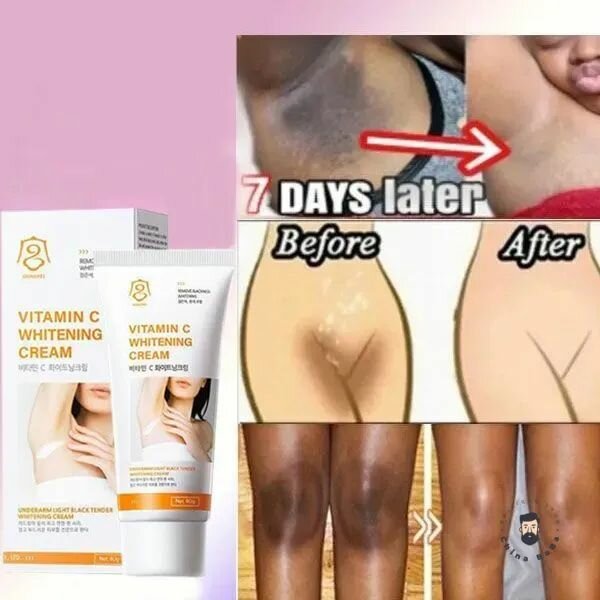 Отбеливающий крем для интимной зоны, тела, ягодиц, бикини, Для всего тела, убирает пигментацию, эффективно отбеливает кожу в интимной зоне