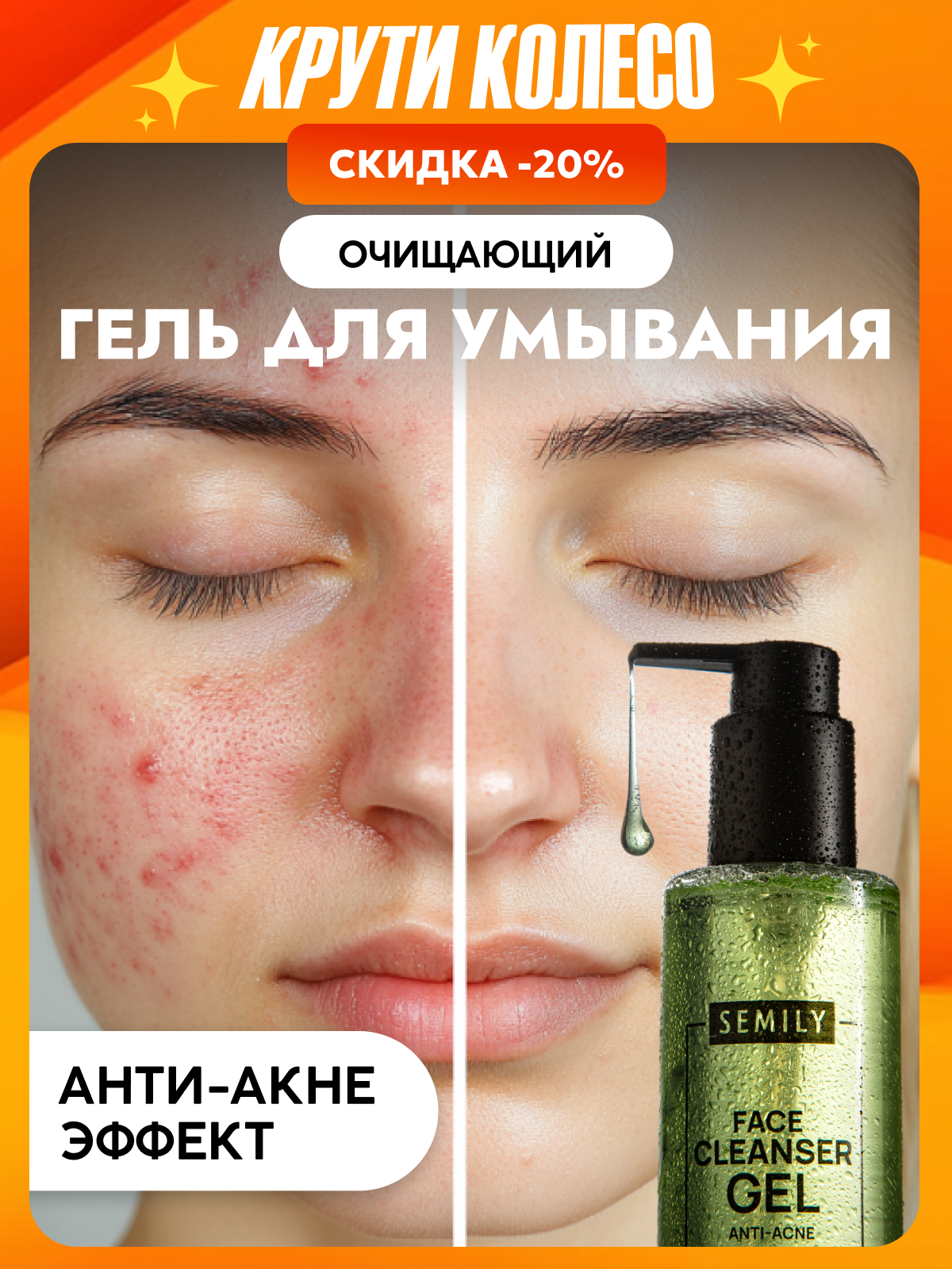 Гель для умывания от прыщей и черных точек Semily, для проблемной кожи, 200 мл