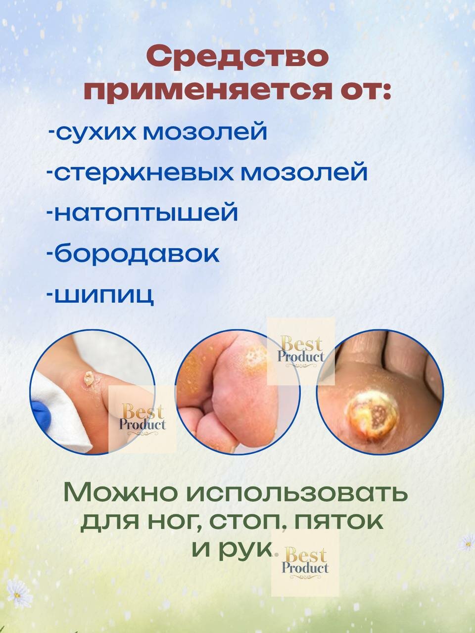 Патч от мозолей, средство от натоптышей, шипиц. Удаление мозолей из сухого кокона. — фото 1