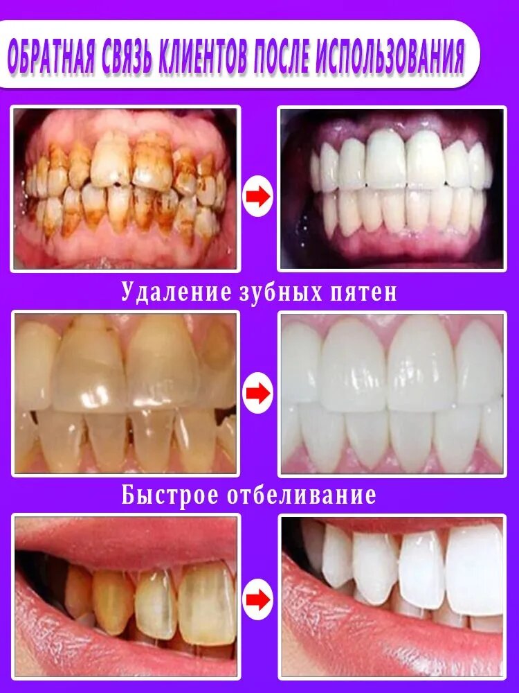 Зубная паста SUSUVETA V34 Whitening Toothpaste для отбеливания зубов 30ml — фото 1