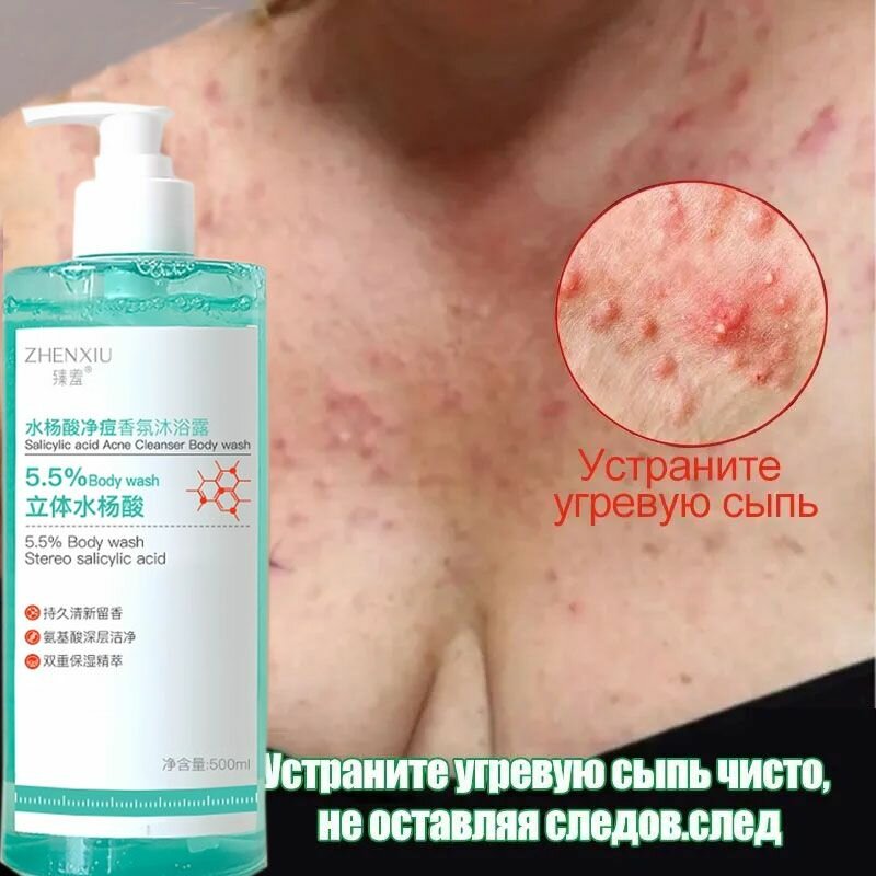 Гель для душа от прыщей, черных точек, и для проблемной кожи, Глубоко очищает кожу тела, очищающий антибактериальный 500 мл средство для проблемной кожи антибактериальный гель для тела средство от прыщей