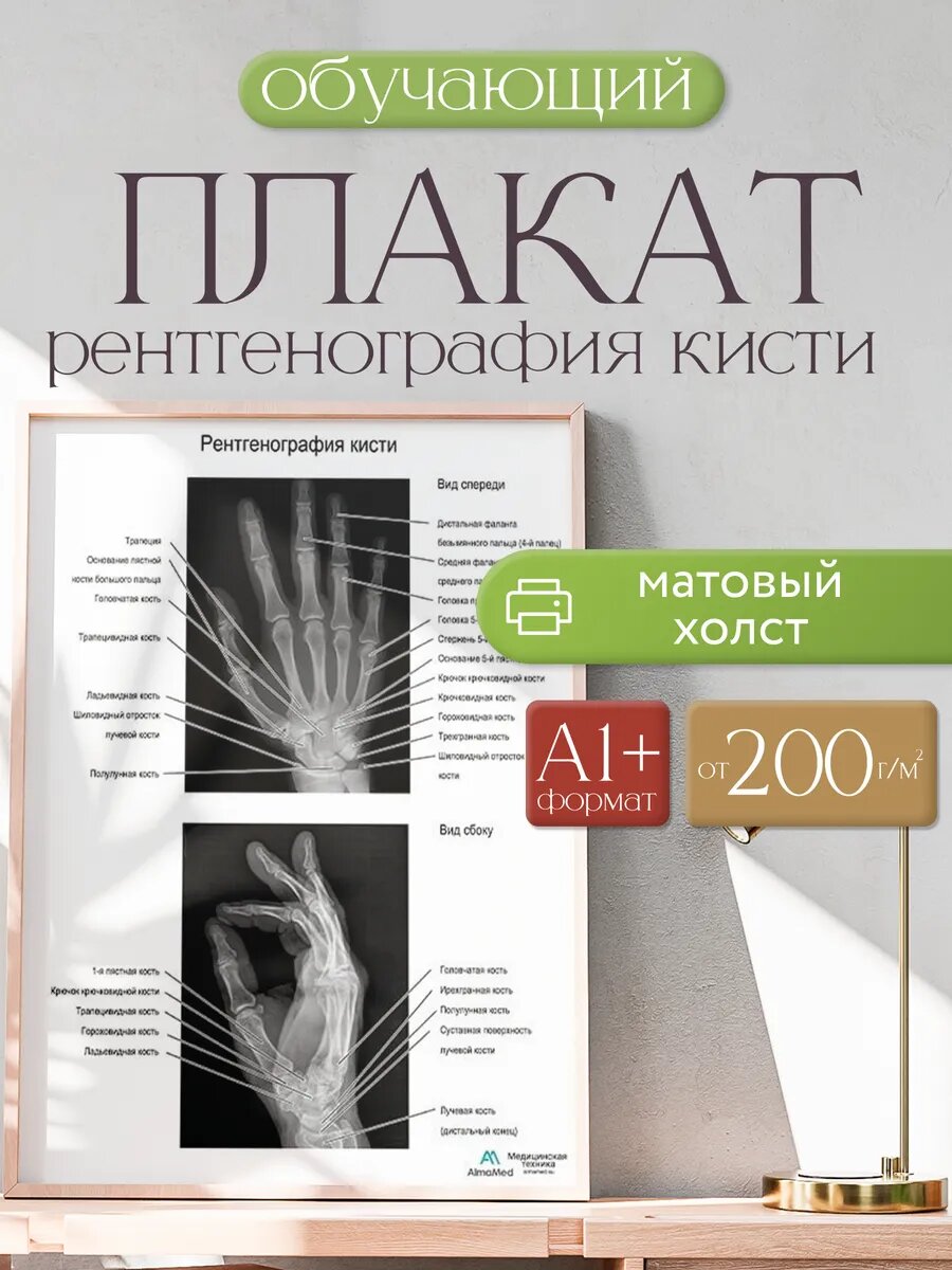 Обучающий плакат "Рентгенография кисти", размер А1+, матовый холст от 200г/м2