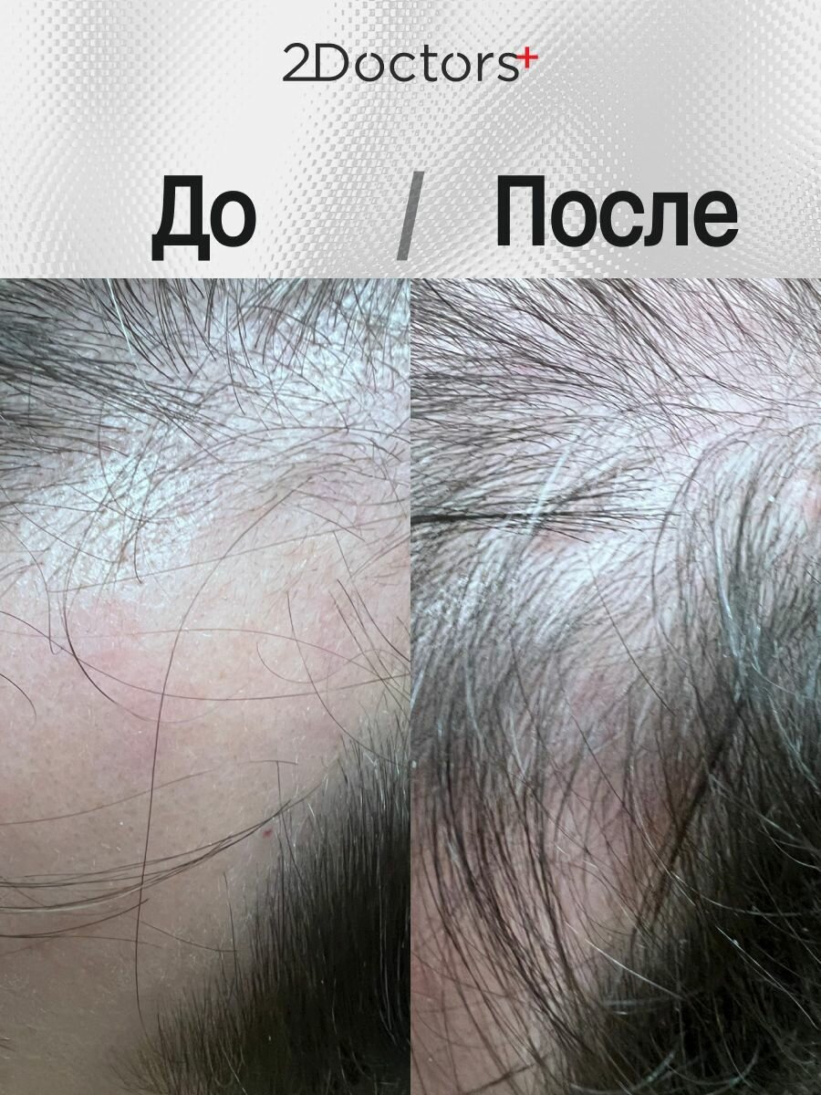 2Doctors Шампунь для волос — фото 1