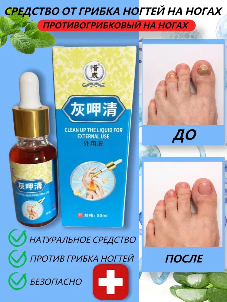 Капли от грибка ногтей/Раствор от онихомикоза