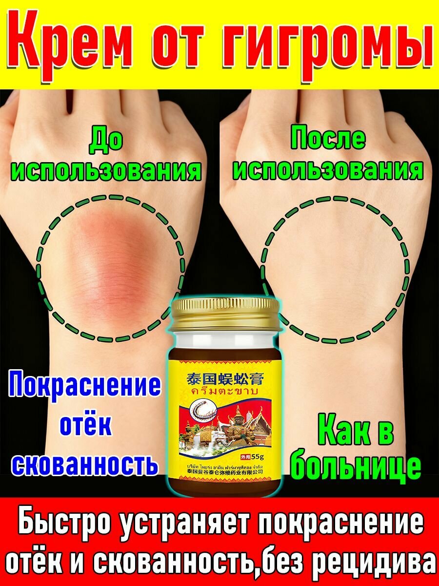 Быстрое облегчение при гигроме и тендините, 55 г. Крем помогает снять боль и отек.