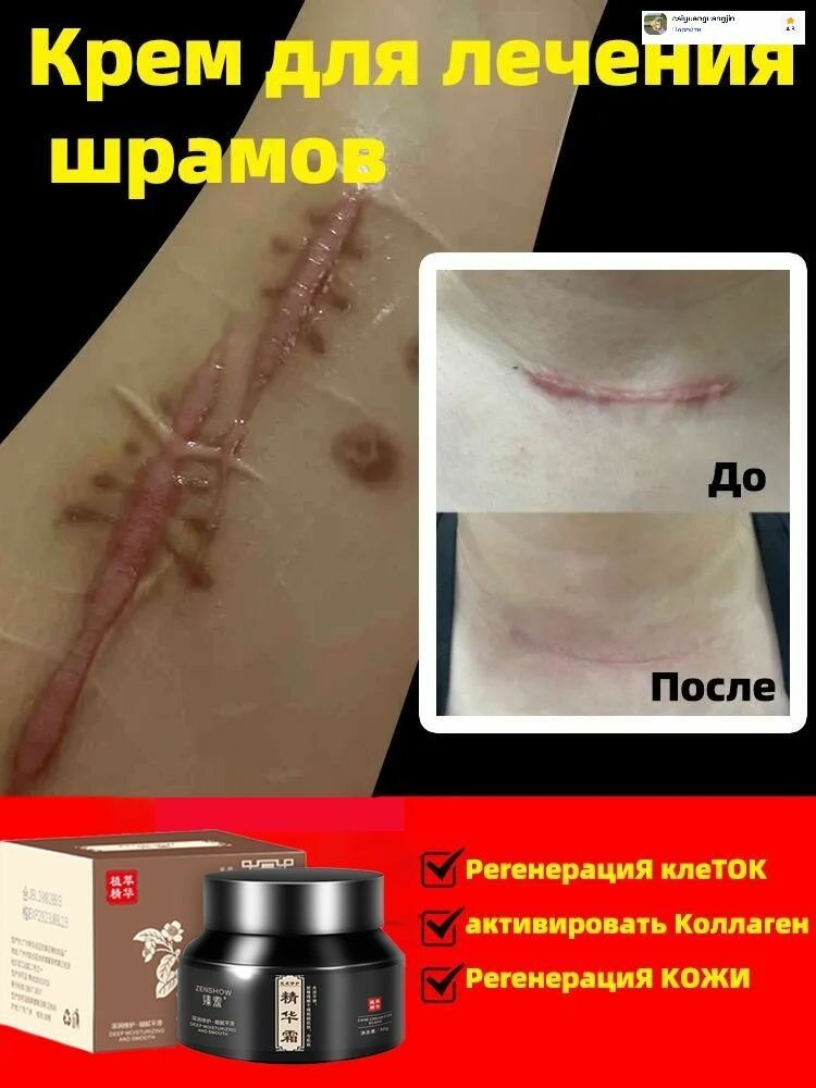 Крем, который уменьшает шрамы и постепенно улучшает состояние кожи