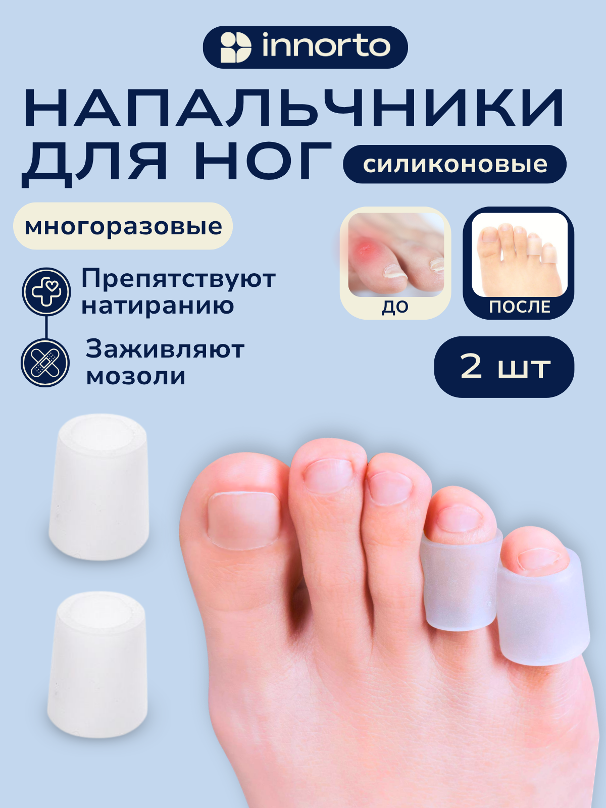 Кольца «INNORTO», артикул 39998, типоразмер универсальный - 1 пара