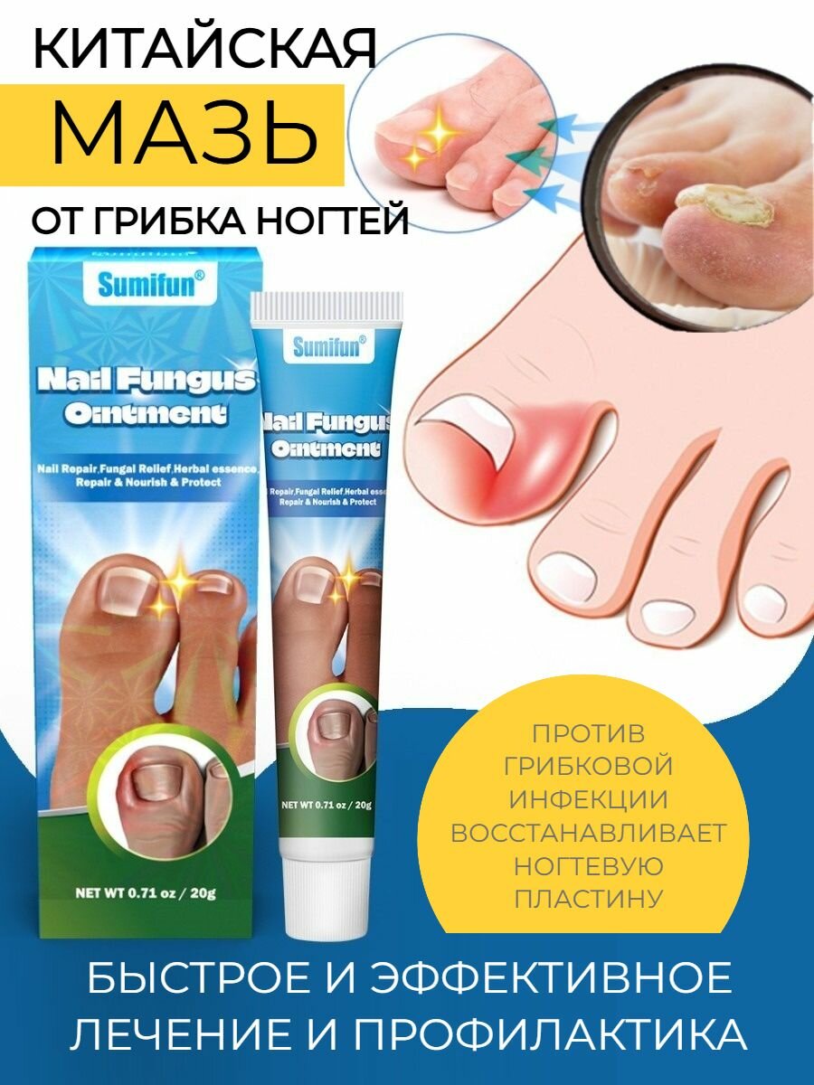 Китайское средство от грибка ногтей 20 гр