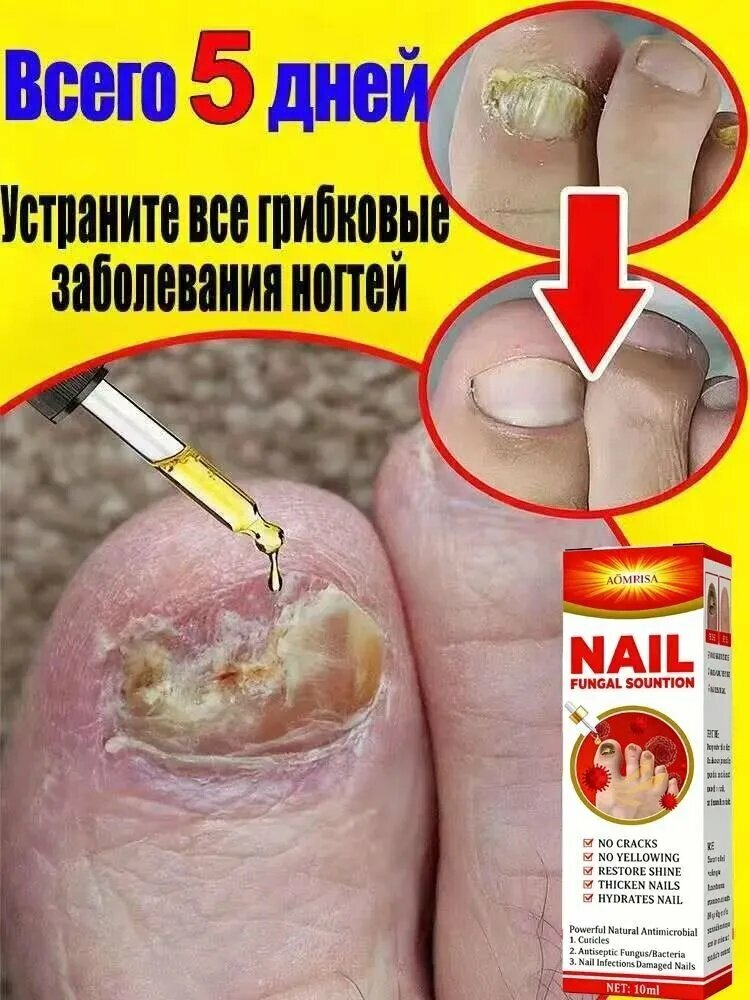 Используется для лечения грибка ногтей на руках и ногах. Лечите грибковые инфекции, укрепляйте и восстанавливайте ногти и роговой слой кожи, а также устраняйте грибок ногтей на ногах.30 мл