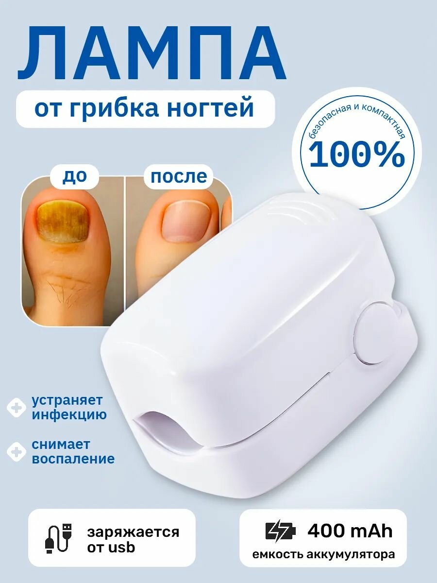 Лампа для лечения грибка ногтей "Ультра", УФ- и LED-свет, с аккумулятором