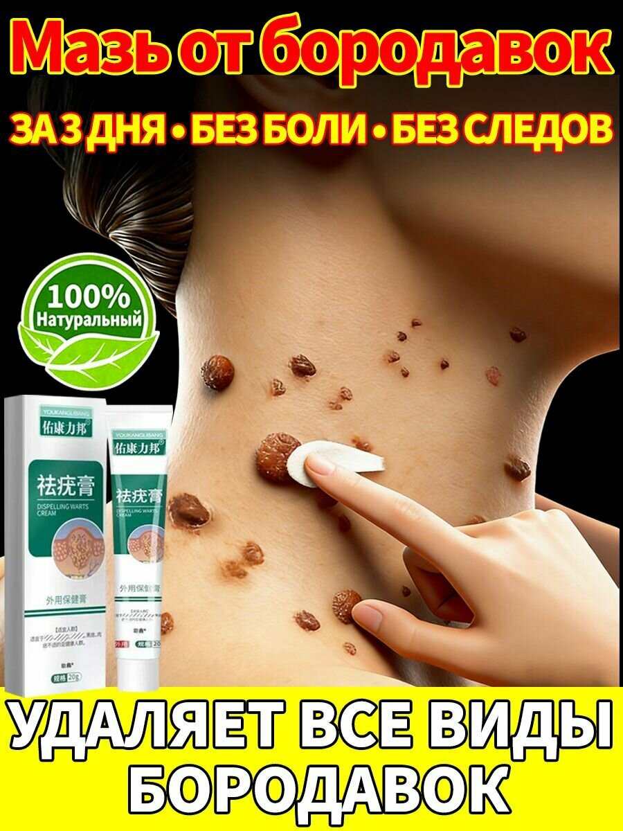 Мазь для лечения бородавок, эффективно удаляет бородавки, папилломы и родинки, подходит для лица и тела, без побочных эффектов
