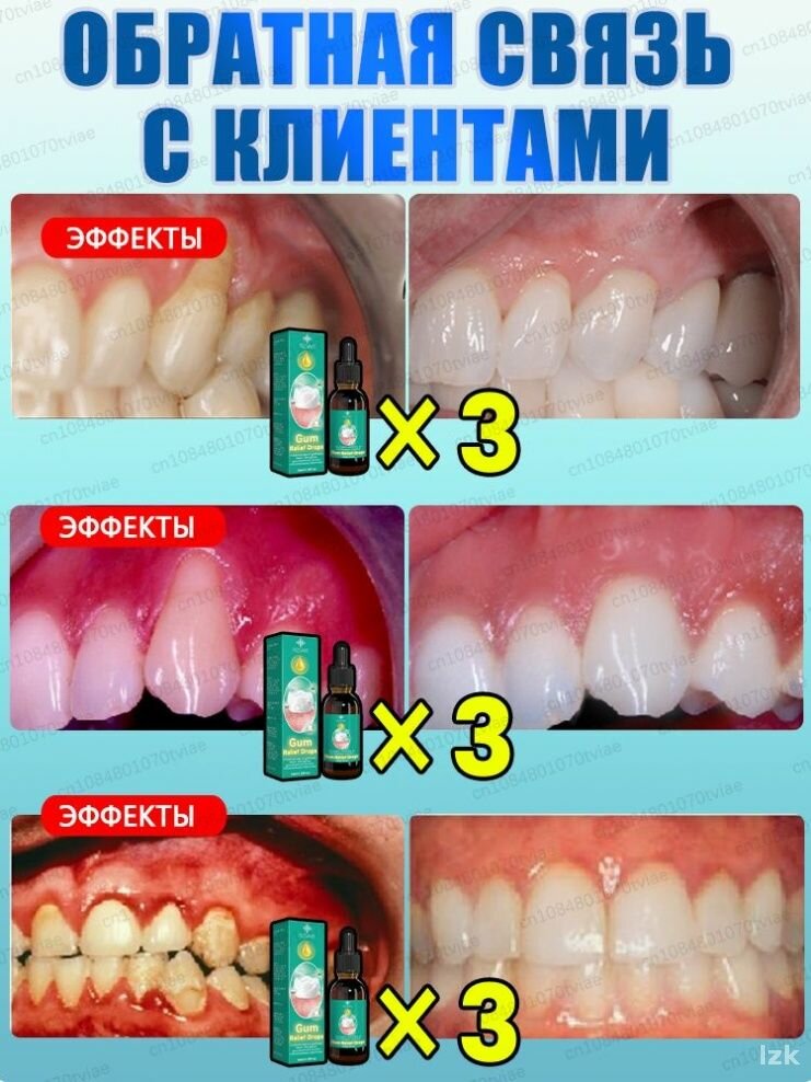 Эксклюзивный концентрат 30 мл для терапии пародонтита и стоматита,