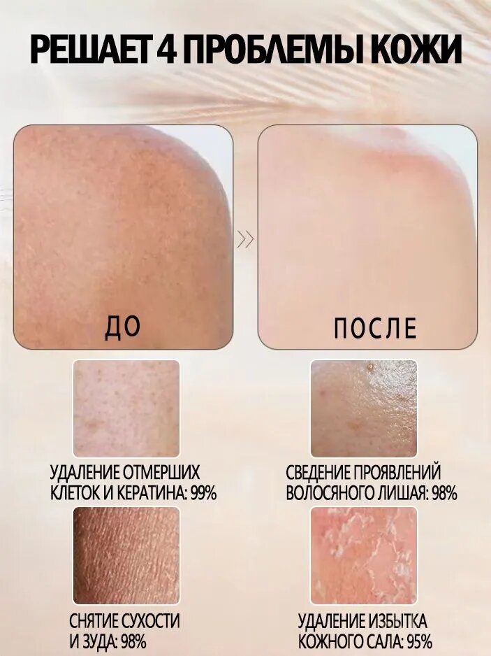 Мочалка — фото 1