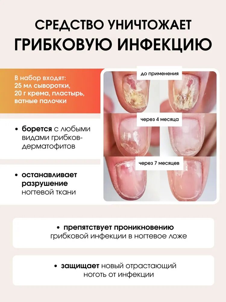 Масло для ногтей — фото 1