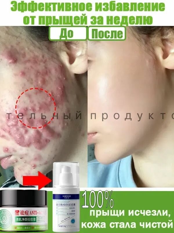 Салициловая мазь от прыщей, направленная на акне и угри, эффективно борется с воспалениями, прыщами и последствиями акне, подходит подросткам и проблемной коже, 100 г.