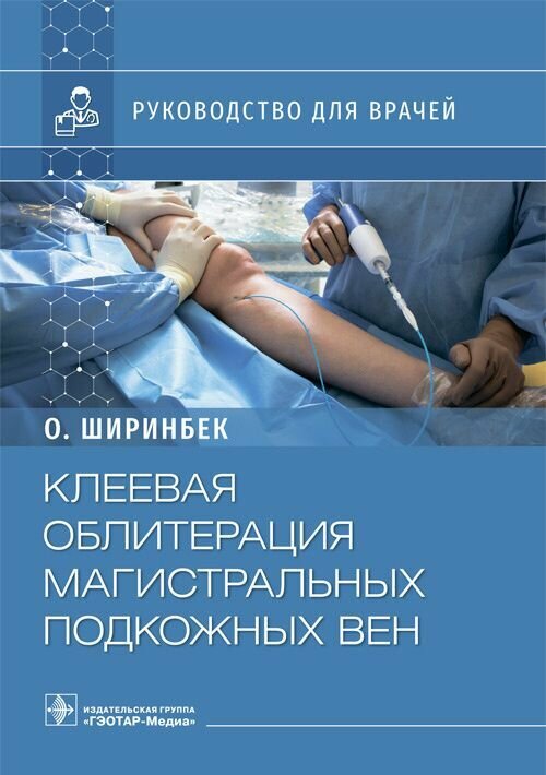 Клеевая облитерация магистральных подкожных вен. Ширинбек.