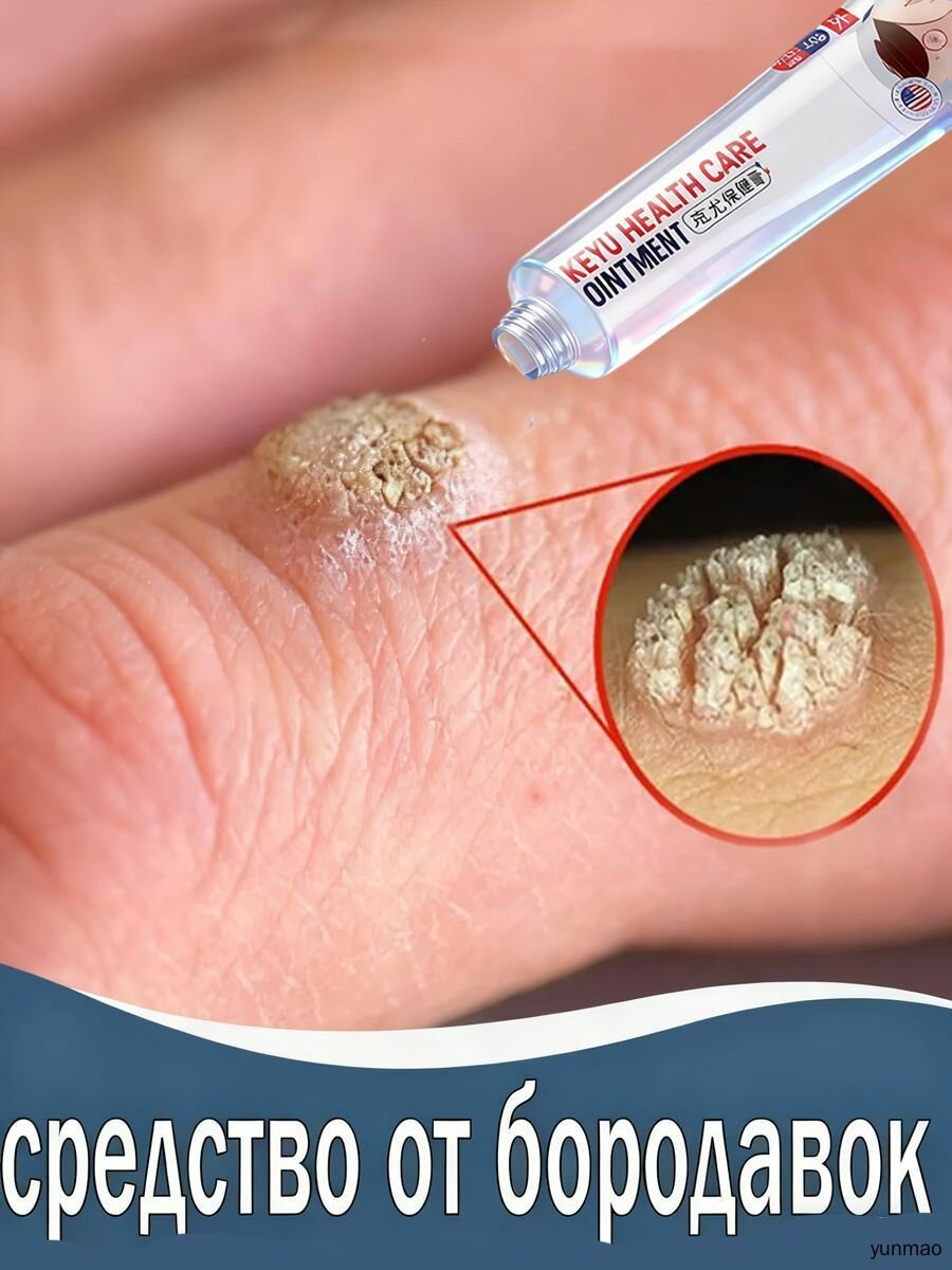 Колломак от бородавок, чистотело, средство против папиллом, от бородавок средство, папиллом и родинок, безболезненно, не оставляет следов,20g